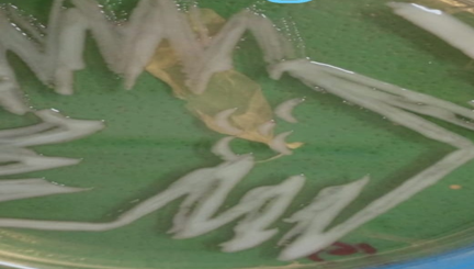 Identification of the Bacterial Pathogen of Ticks and Ticks Infestation ...